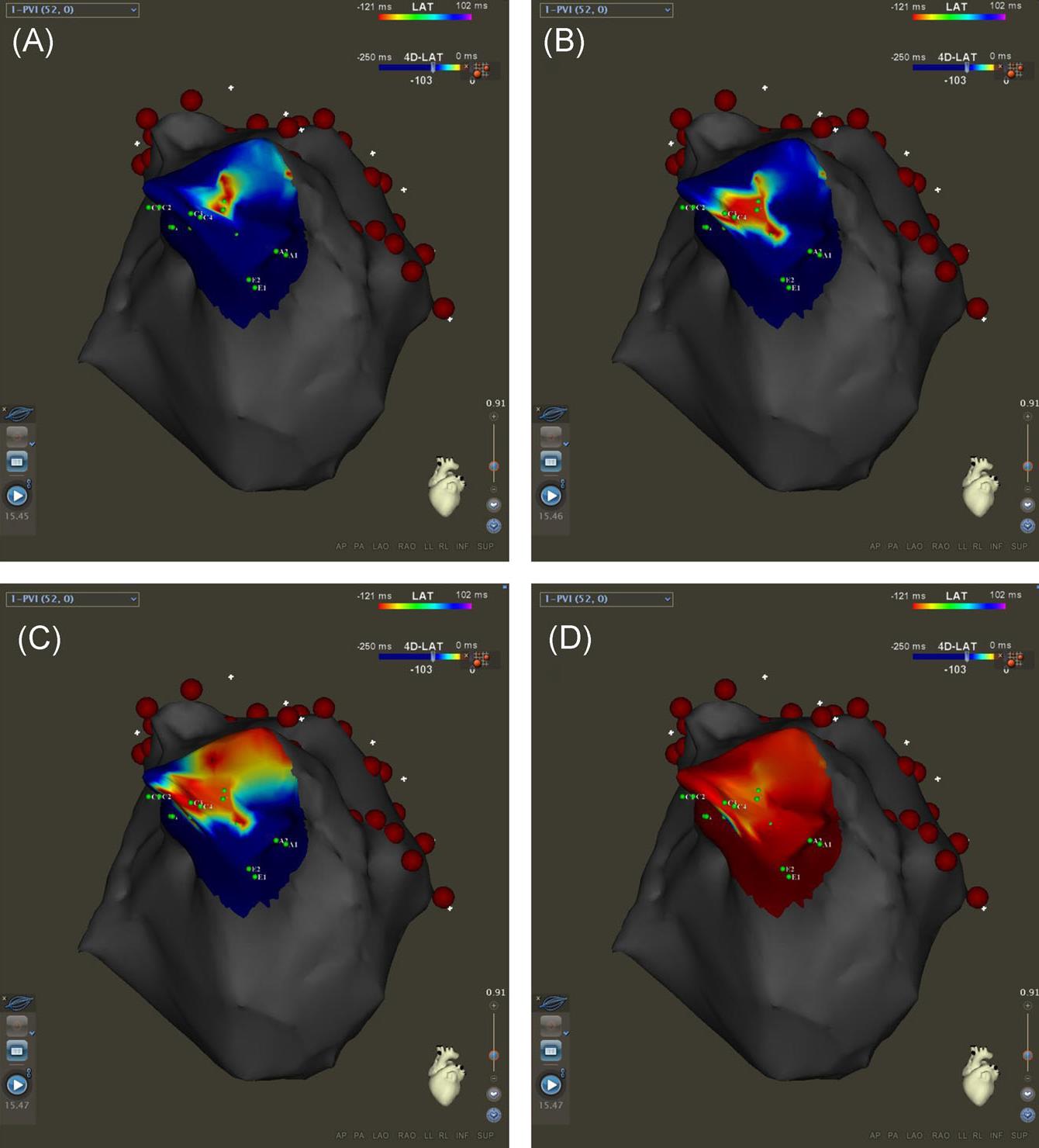 臨床研究 不整脈 - 東京医科歯科大学 医学部附属病院 循環器内科