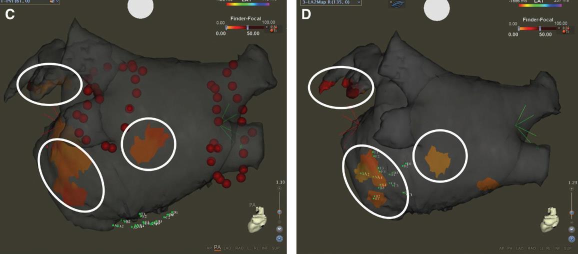 臨床研究 不整脈 - 東京医科歯科大学 医学部附属病院 循環器内科